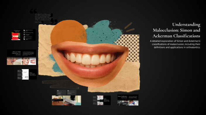 Understanding Malocclusion: Simon and Ackerman Classifications by ...