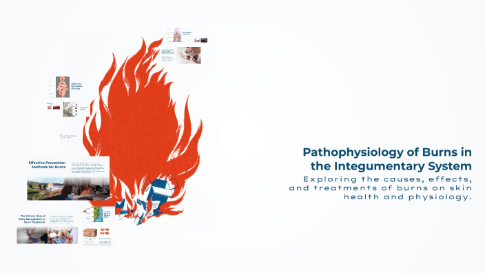 Pathophysiology of Burns in the Integumentary System by zaya neal on Prezi