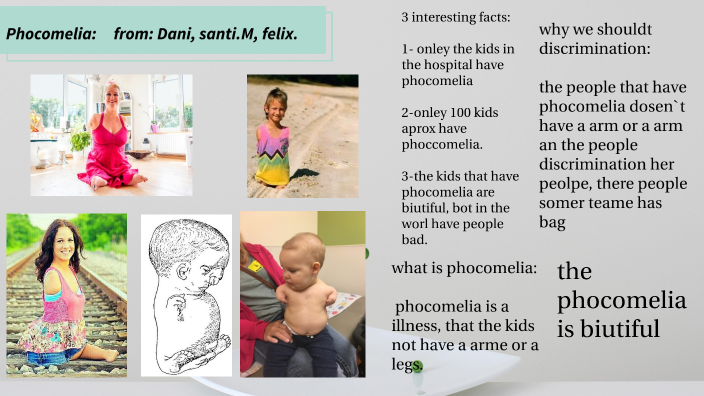 phocomelia by santi m on Prezi
