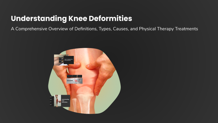 Understanding Knee Deformities by Alaa Elsayed on Prezi