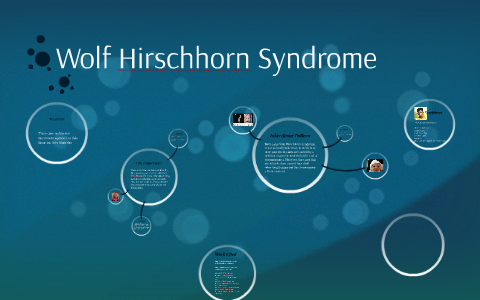 Wolf Hirschhorn Syndrome by Cameron Luz on Prezi
