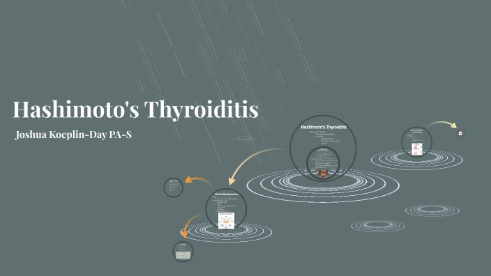 Hashimoto's Thyroiditis by Josh Koeplin-Day on Prezi