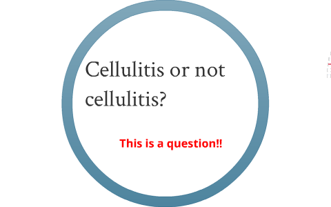 Cellulitis Mimics by Tsun-cheng Wang on Prezi