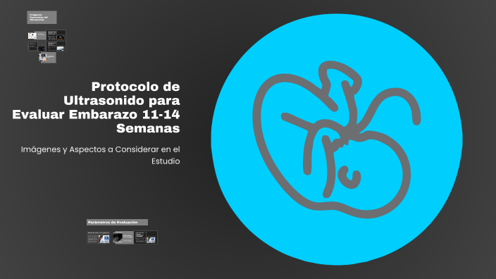 Protocolo de Ultrasonido para Evaluar Embarazo 11-14 Semanas by sofia murrieta on Prezi