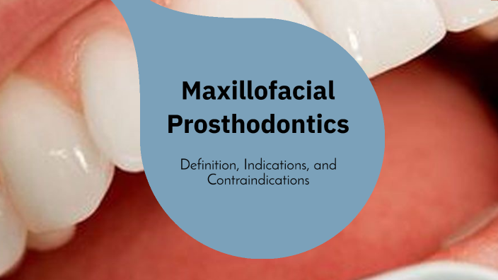 Understanding Maxillofacial Prosthodontics by somaiah Al-humaidi on Prezi