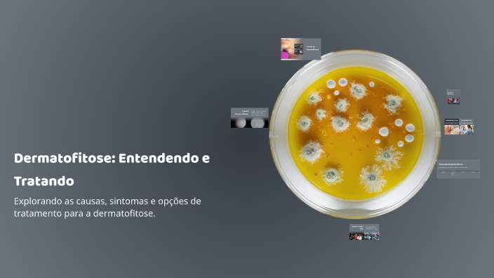 Dermatofitose: Entendendo e Tratando by DHULIANY SOUZA on Prezi