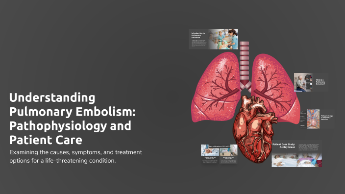 Understanding Pulmonary Embolism: Pathophysiology and Patient Care by ...