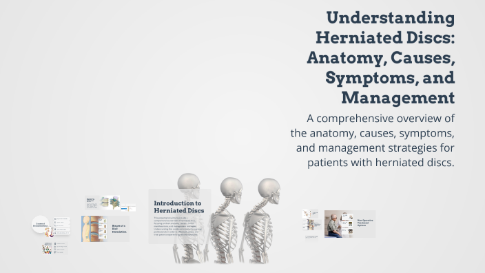 Understanding Herniated Discs: Anatomy, Causes, Symptoms, and ...