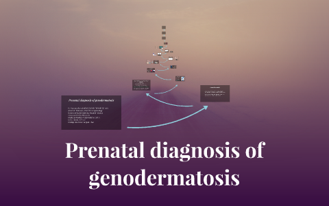 Prenatal diagnosis of genodermatosis by Palak Sharma on Prezi