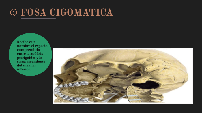 FOSA CIGOMTICA by Marisela Marquez on Prezi