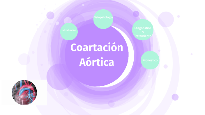 Coartación by Valentina Yañez Egoaguirre on Prezi