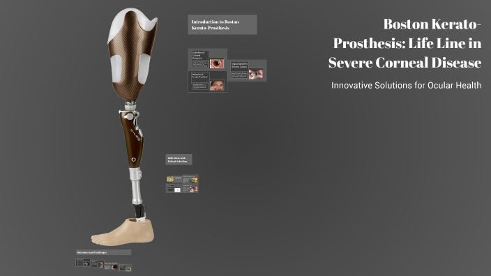 Boston Kerato-Prosthesis: Life Line in Severe Corneal Disease by ...