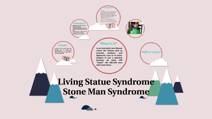 Living Statue Syndrome by isabela franco martinez on Prezi