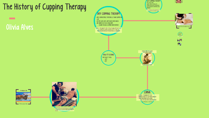 The History of Cupping Therapy by Olivia Alves on Prezi