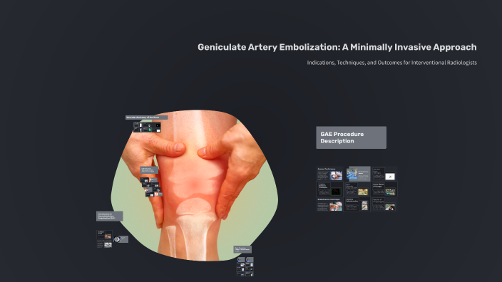 Geniculate Artery Embolization: A Minimally Invasive Approach by Pedro ...