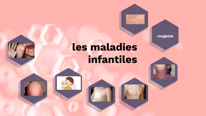 les maladies infantiles by Gisela Balet on Prezi