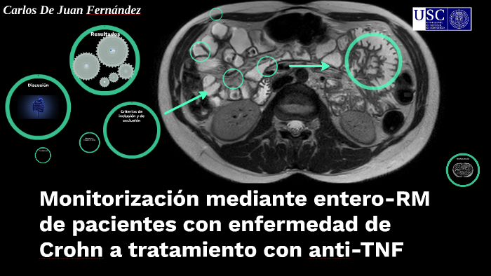 Monitorización mediante entero-RM de pacientes con enfermeda by de Jufe ...