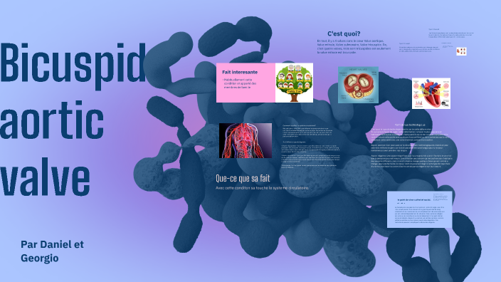 Bicuspide aortic valve by Daniel Wilkinson on Prezi