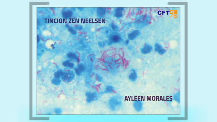 TINCION ZEN NEELSEN by ayleen morales sepulveda on Prezi