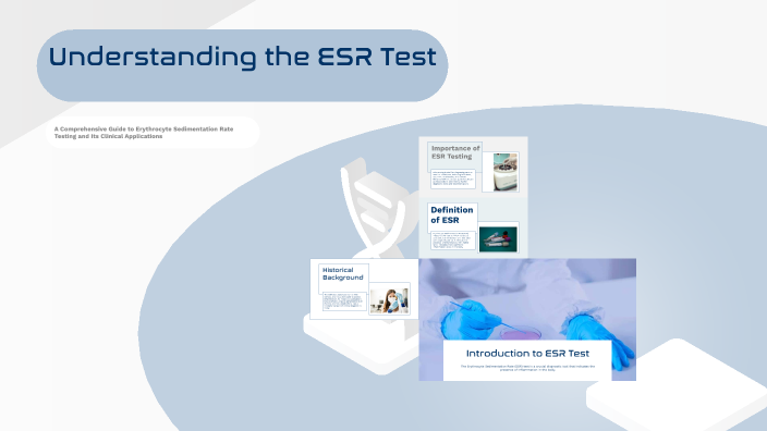 Understanding the ESR Test by maisaa zawahrah on Prezi