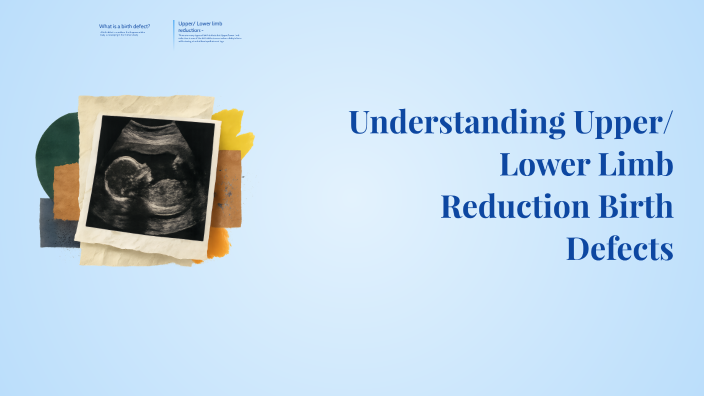 Understanding Upper/Lower Limb Reduction Birth Defects by Arshiya Imran ...