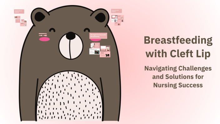 Breastfeeding with Cleft Lip by Logyn Frapolly on Prezi