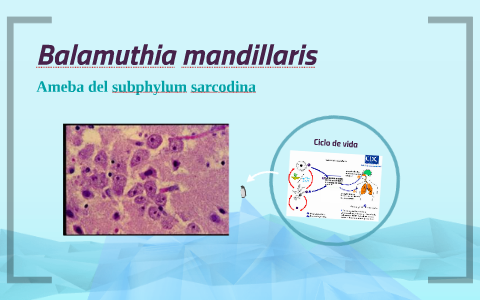 Balamuthia mandrillaris by camila valle on Prezi