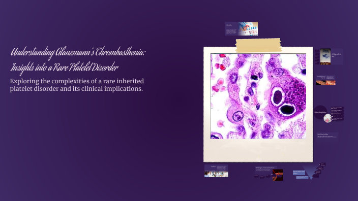 Understanding Glanzmann’s Thrombasthenia: Insights into a Rare Platelet ...