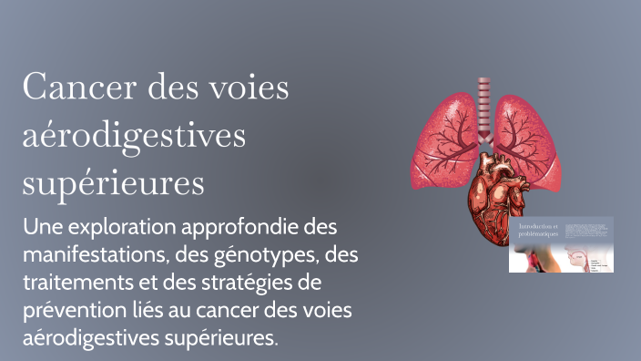 Cancer des voies aérodigestives supérieures by alex franchi on Prezi