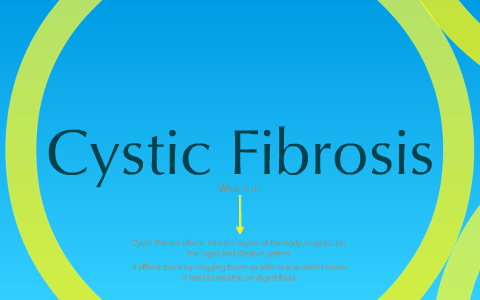Cystic Fibrosis by Charlie Luscombe on Prezi