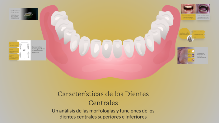 Características de los Dientes Centrales by Lal Lali on Prezi