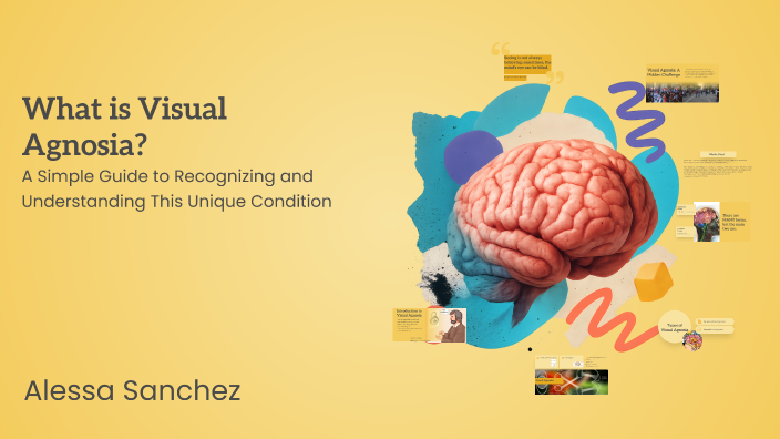 Understanding Visual Agnosia by Alessa Sanchez on Prezi