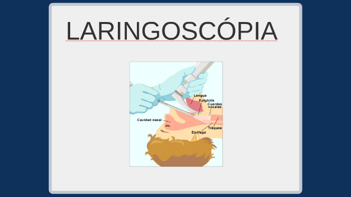 La Laringoscopia by Johana Elizabeth on Prezi