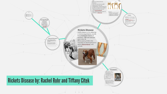 Rickets Disease by: Rachel Rohr and Tiffany Citek by rachel rohr on Prezi