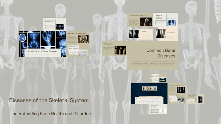 Diseases of the Skeletal System by ayuda ortega on Prezi