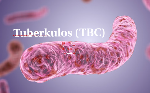 Tuberkulos by Vilhelm Wirell on Prezi