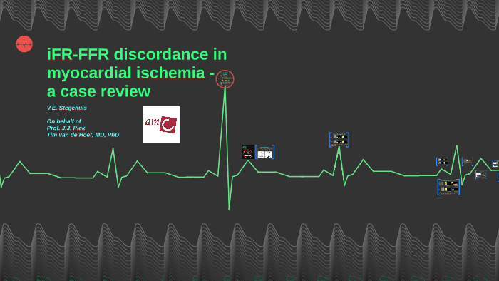 iFR-FFR discordance in myocardial ischemia by on Prezi