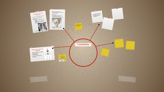 Idag lär vi oss mera om skelettet! by Essi Ahokoski on Prezi