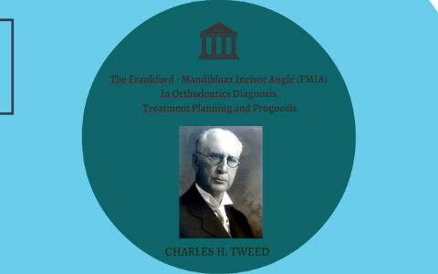 The Frankford - Mandibluar Incisor Angle (FMIA) by Jose Luis Dominguez