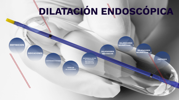 DILATACIÓN ENDOSCÓPICA by Daniel Fernández on Prezi