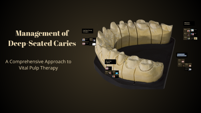 Management of Deep-Seated Caries by noor alhuda on Prezi