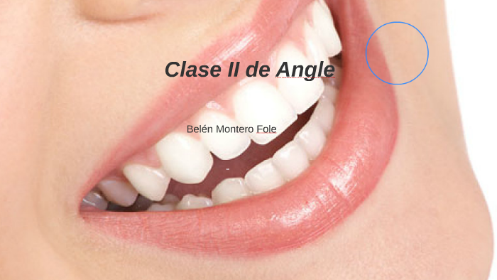 tratamiento de la clase II de Angle by belen montero on Prezi