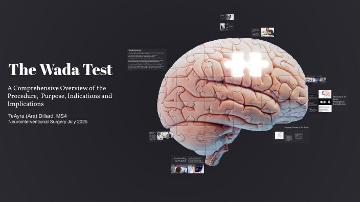 Understanding the Wada Test by TeAyra Dillard on Prezi