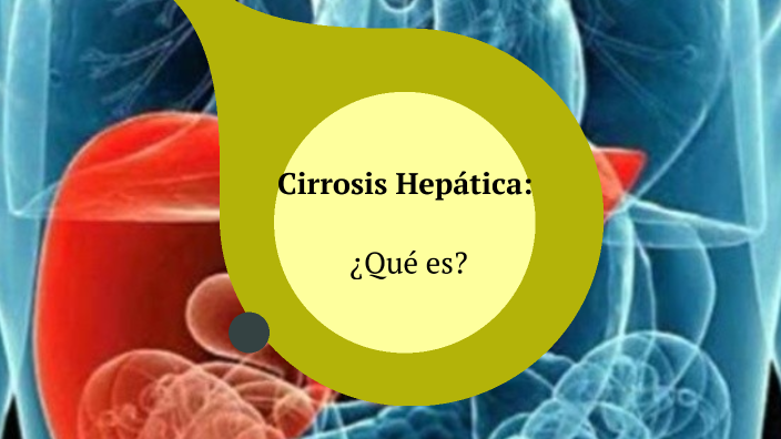 Cirrosis Hepática: Abordaje de Enfermería by benja casin on Prezi