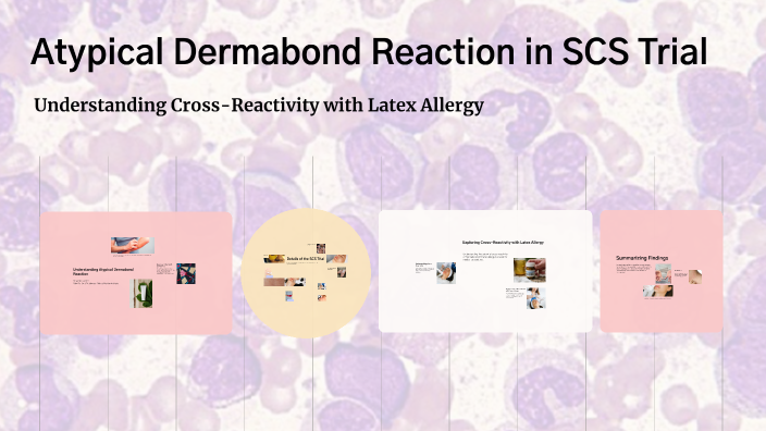 Atypical Dermabond Reaction in SCS Trial by Brian Singer on Prezi