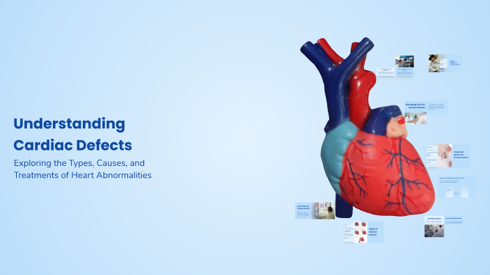 Understanding Cardiac Defects by Jazmyne Marino on Prezi