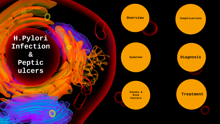 H.pylori and peptic ulcers by Daniel Dumov on Prezi