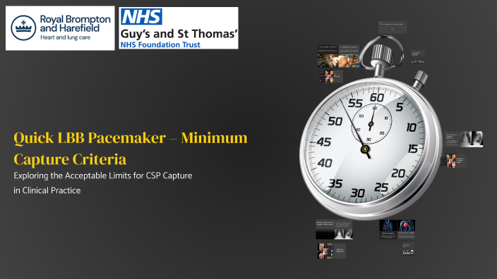 Quick LBB Pacemaker – Minimum Capture Criteria by Davide Fabbricatore ...