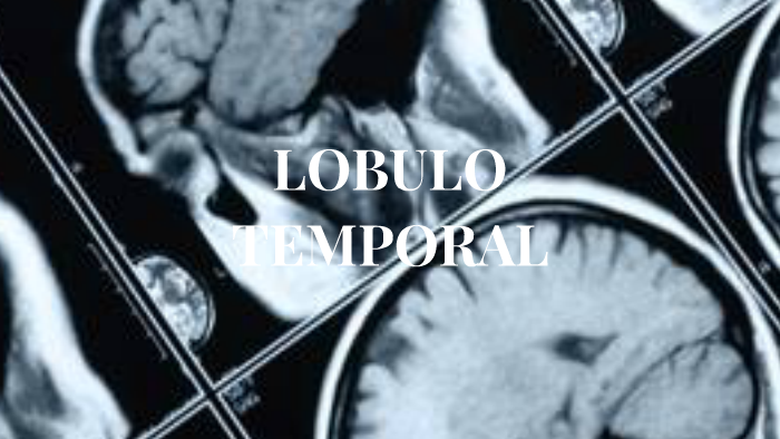 LOBULO TEMPORAL by Elvis Dominguez on Prezi