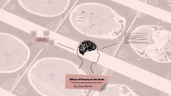Effects of Poverty on the Brain by Jenna M on Prezi